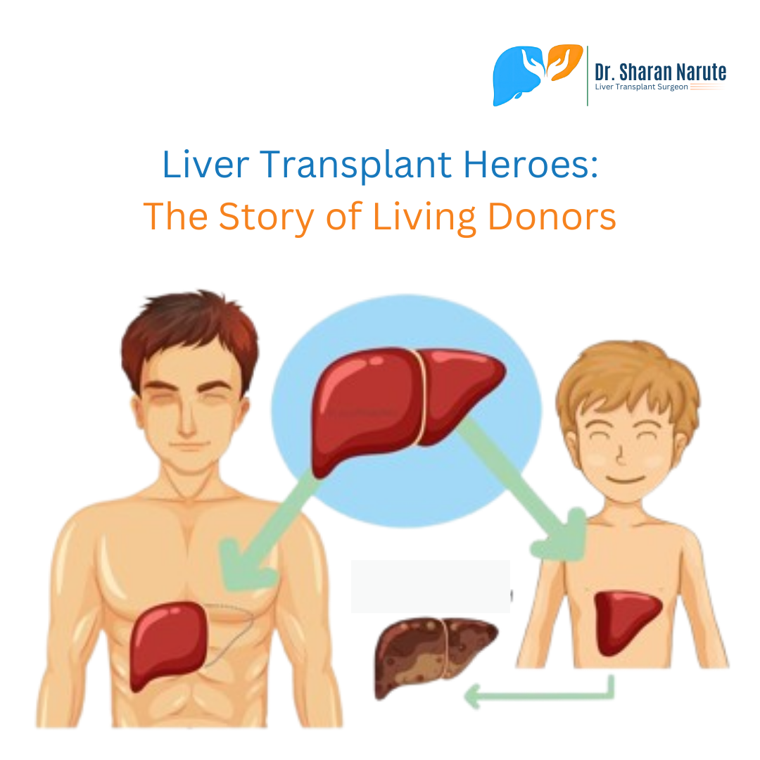 Liver Transplant Heroes: The Story of Living Donors - Dr. Sharan Narute